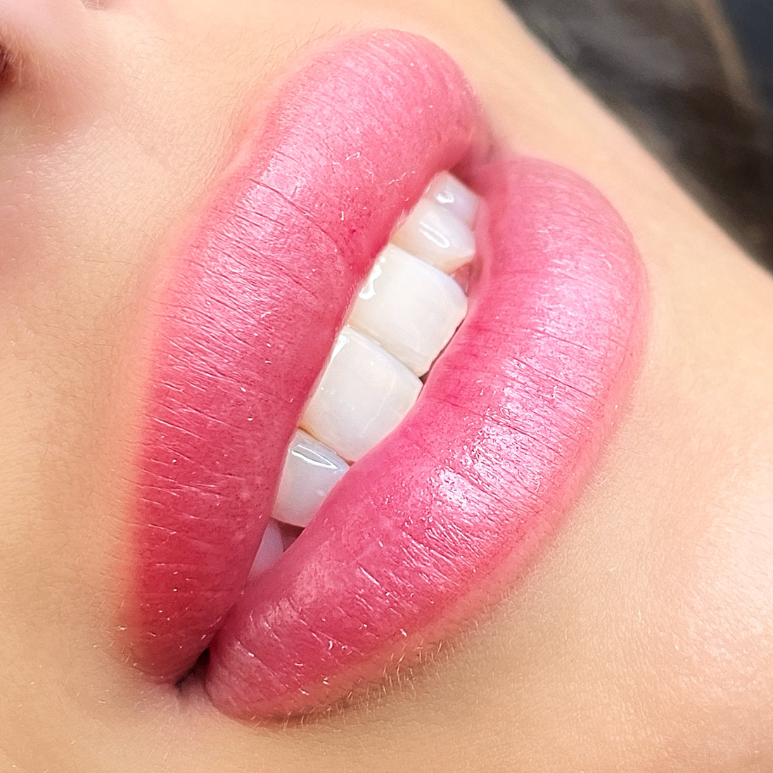 LABIOS - Nanopigmentación Labial - LA CROIX URUGUAY