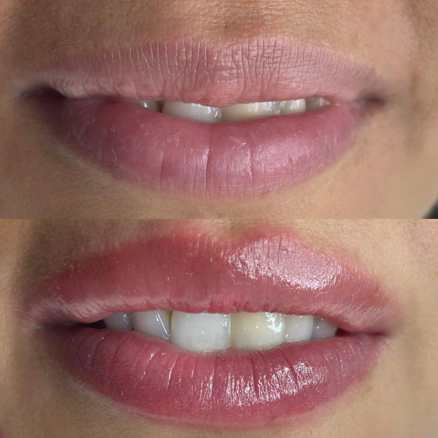 LABIOS - Nanopigmentación Labial - LA CROIX URUGUAY